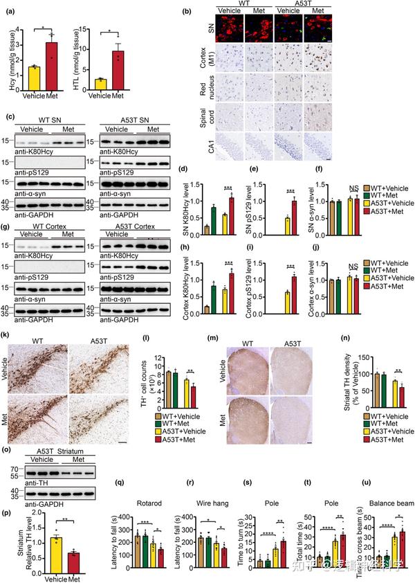 Aging Cell︱武汉大学人民医院张振涛团队揭示同型半胱氨酸修饰α-突触核蛋白在帕金森病中的作用 - 知乎