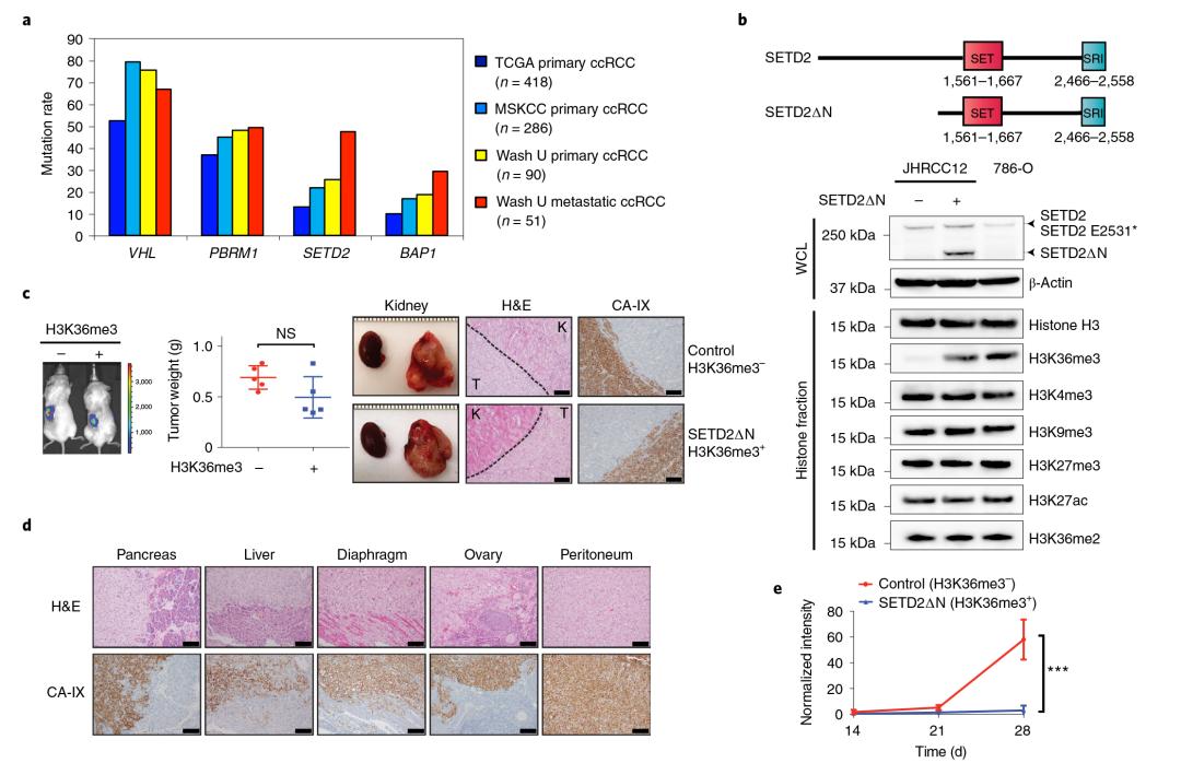 SETD2的缺失到底如何促进癌细胞的转移？ - 知乎