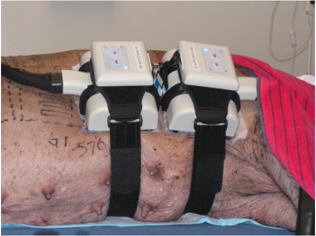 Rox Anderson：从激光医学之父到最成功的医生创业者 - 知乎