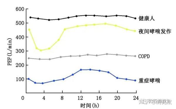 呼气峰值流量（PEF）在哮喘诊断与预测ICU患者脱机拔管时机的应用 - 知乎