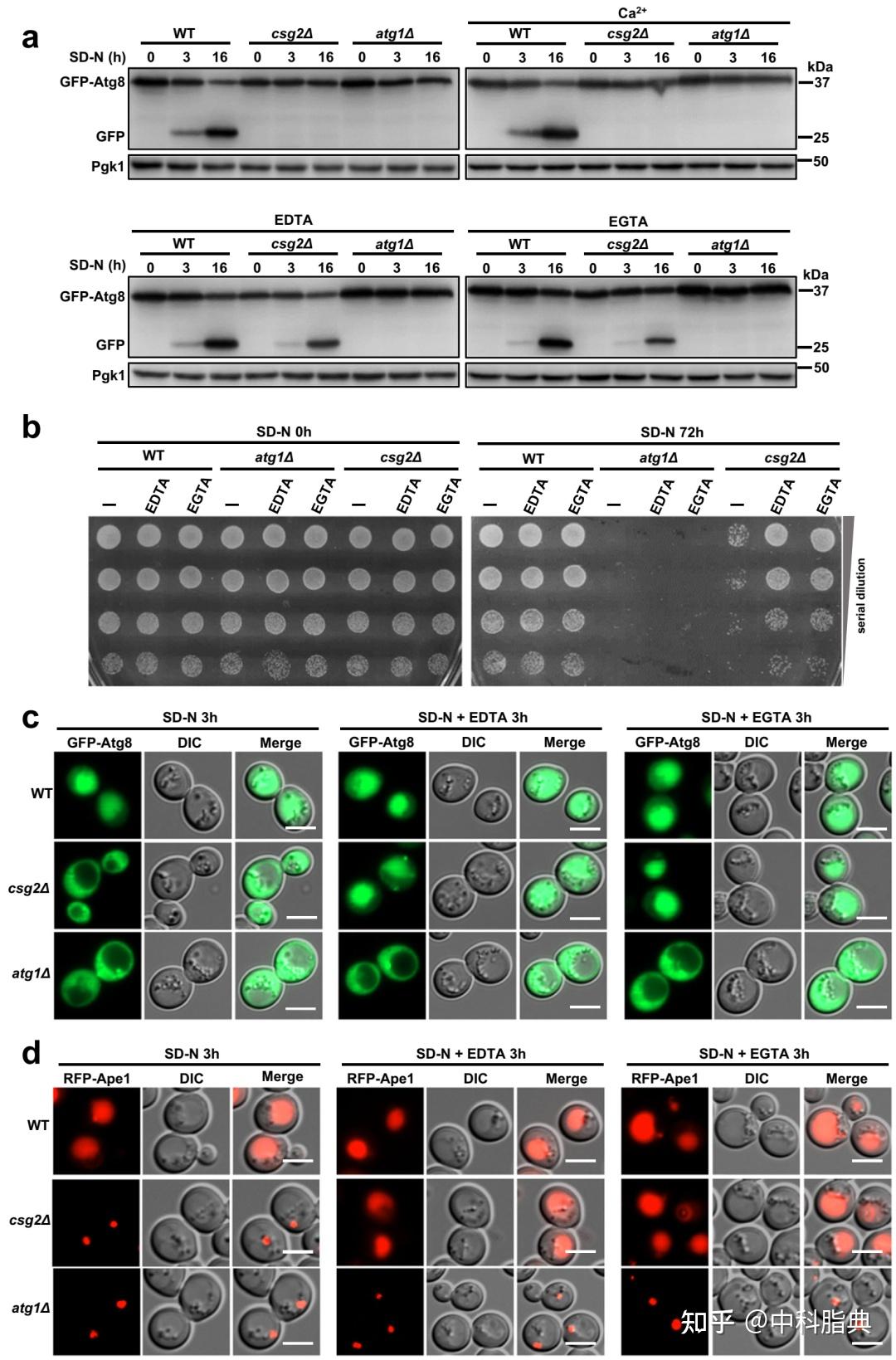 Nat Commun: 酵母脂质组学分析产品助力揭示内质网钙通道Csg2调节自噬的相关机制 - 知乎