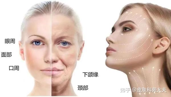 抗衰新选择——5D胶原光（附疗后注意事项） - 知乎