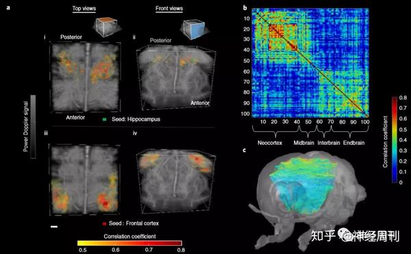 Science和nature硬核发布：超声成像时代来了，小鼠全脑成像更快了 知乎 3043