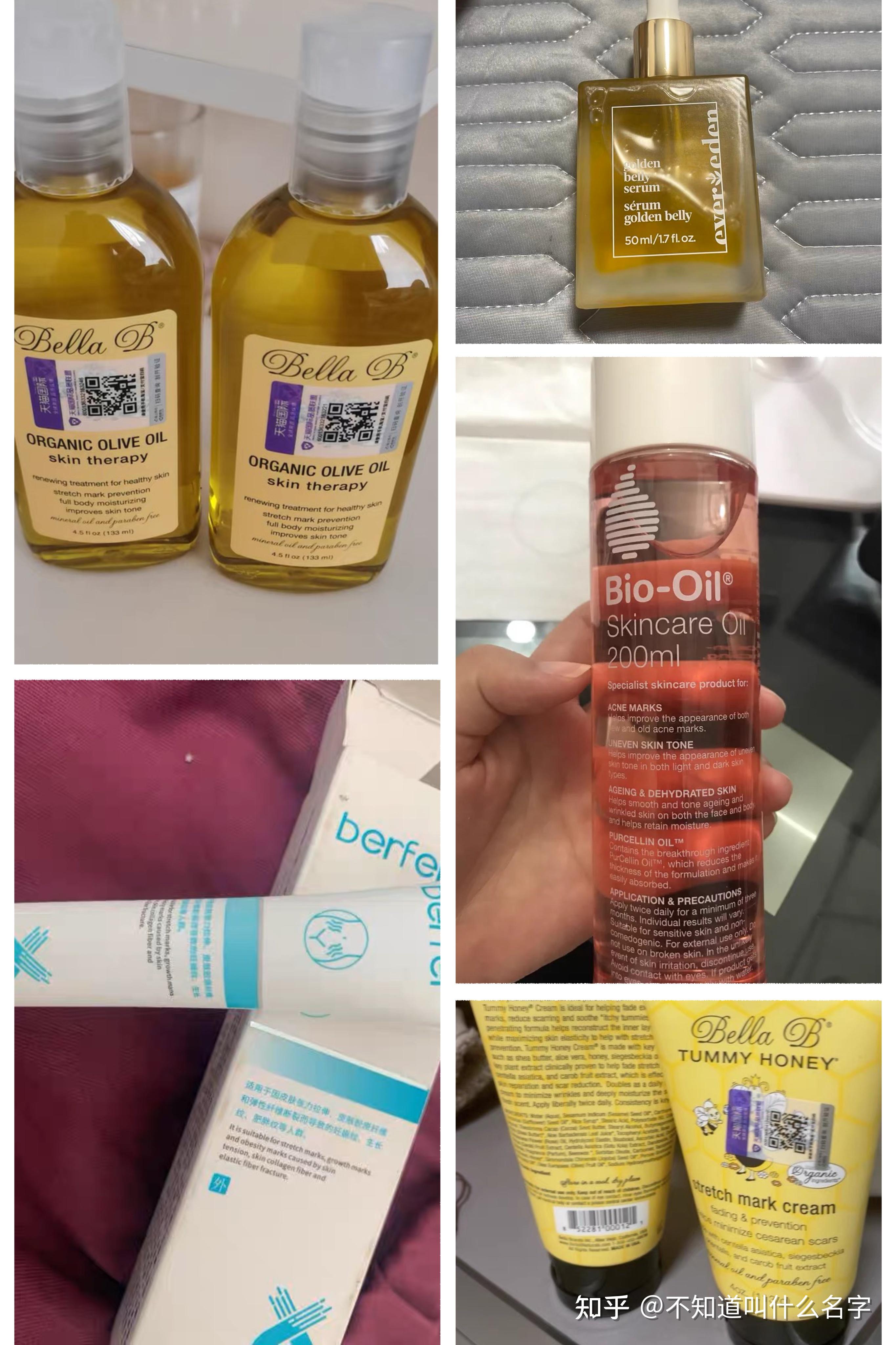 7年了,我的激素纹(肥胖纹)终于离我而去了 知乎