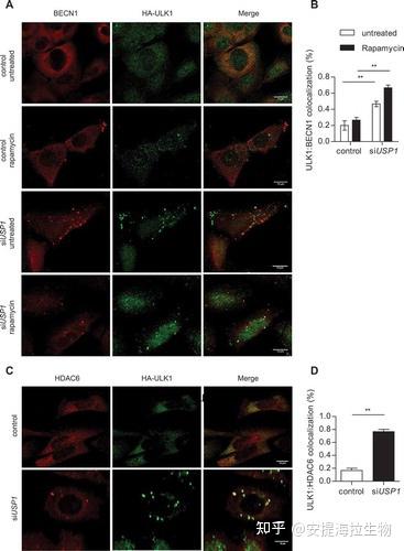 USP1靶向ULK1并调节其细胞区室化和自噬 - 知乎