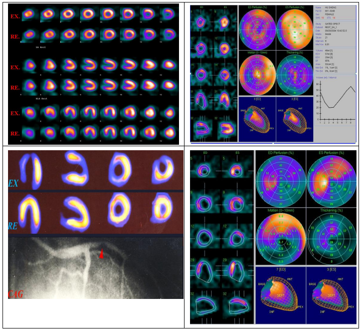 广州皇家丽肿瘤医院引进新一代SPECT/CT，将开展核医学精准诊疗 - 知乎