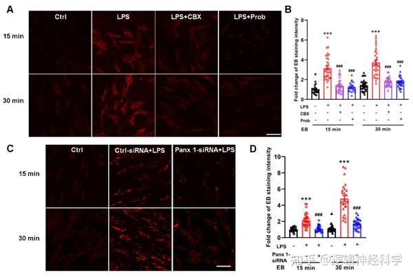 J Neuroinflammation︱南通大学陈罡课题组揭示施万细胞Pannexin 1通过介导炎症反应调节神经病理性疼痛 - 知乎
