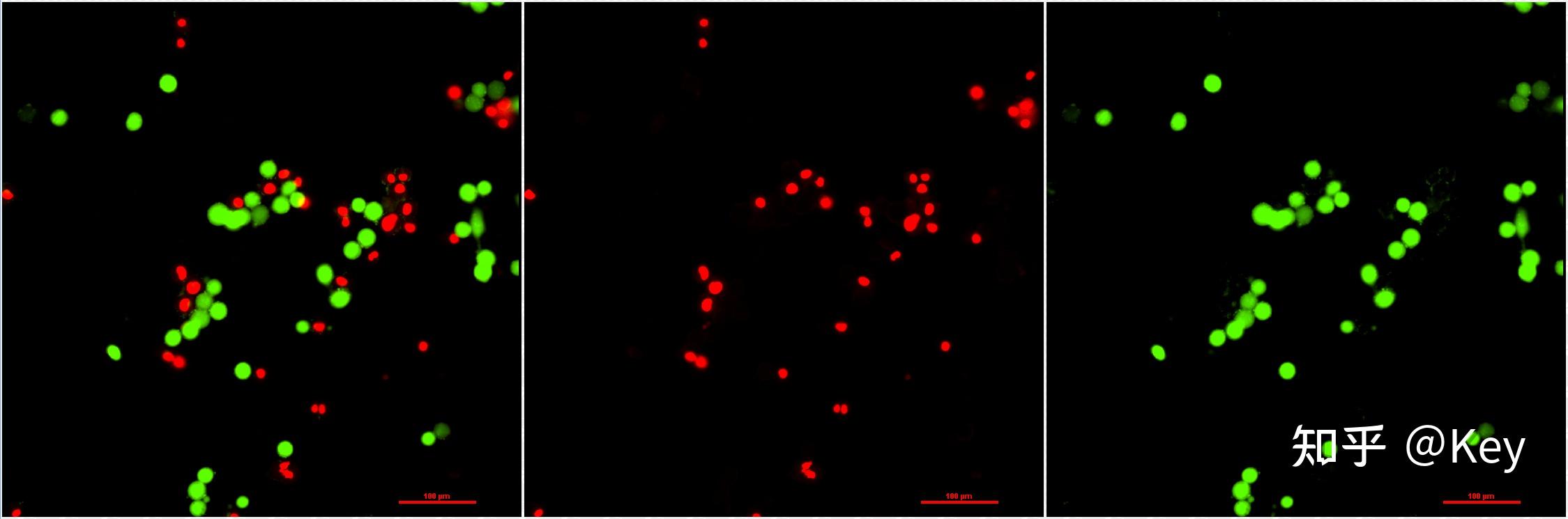 Calcein AM/PI染色活/死细胞的结果如何分析？ - 知乎