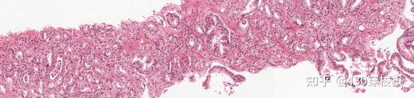 深度学习与医疗影像 —— 数据集整理 - 知乎