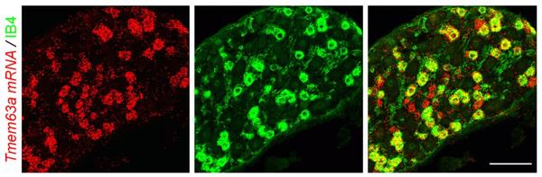 NB2023年第2期封面：神经瘤参与和调节慢性截肢后疼痛形成的机制 - 知乎