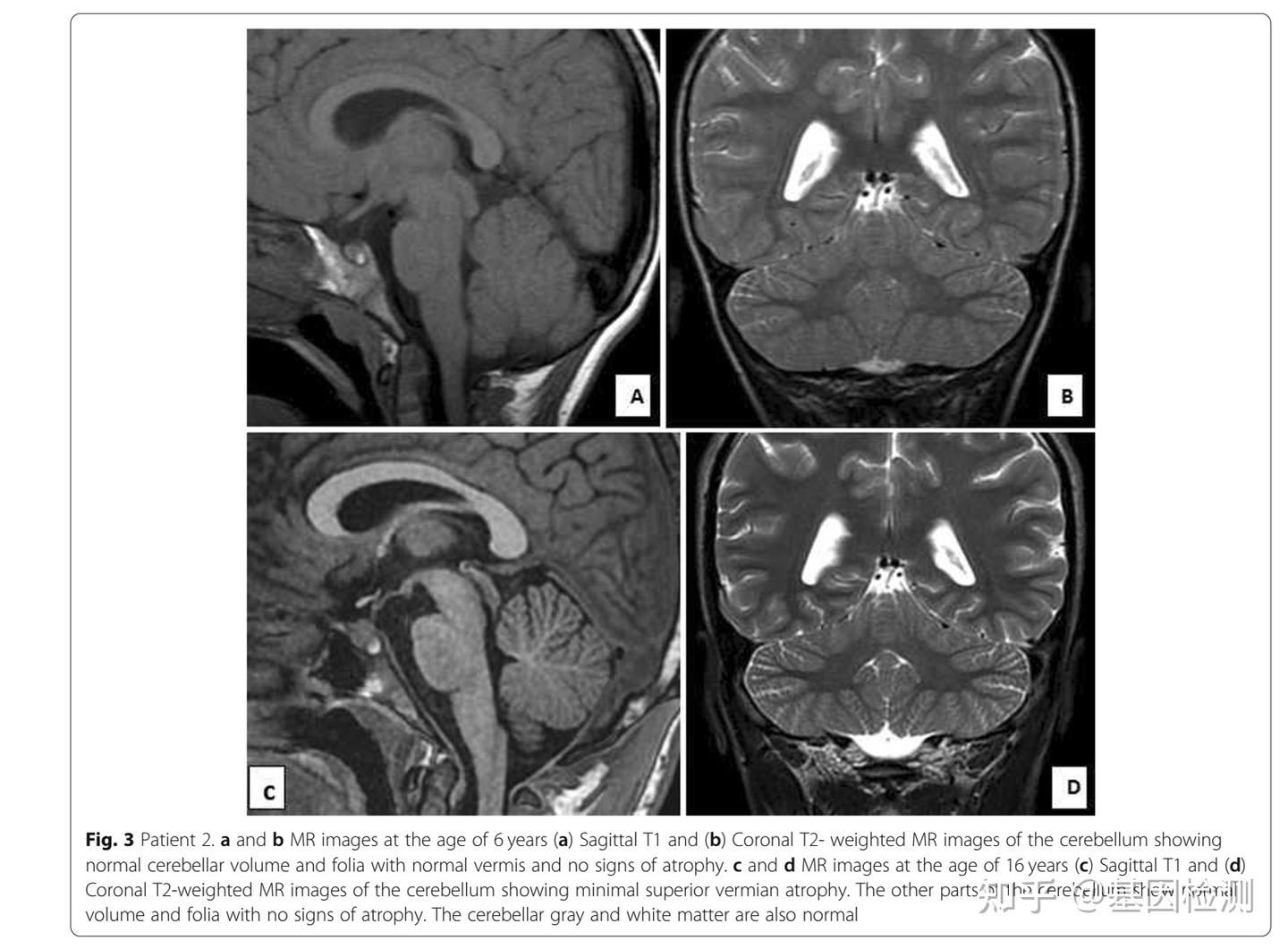 RUBCN基因总结 - 知乎