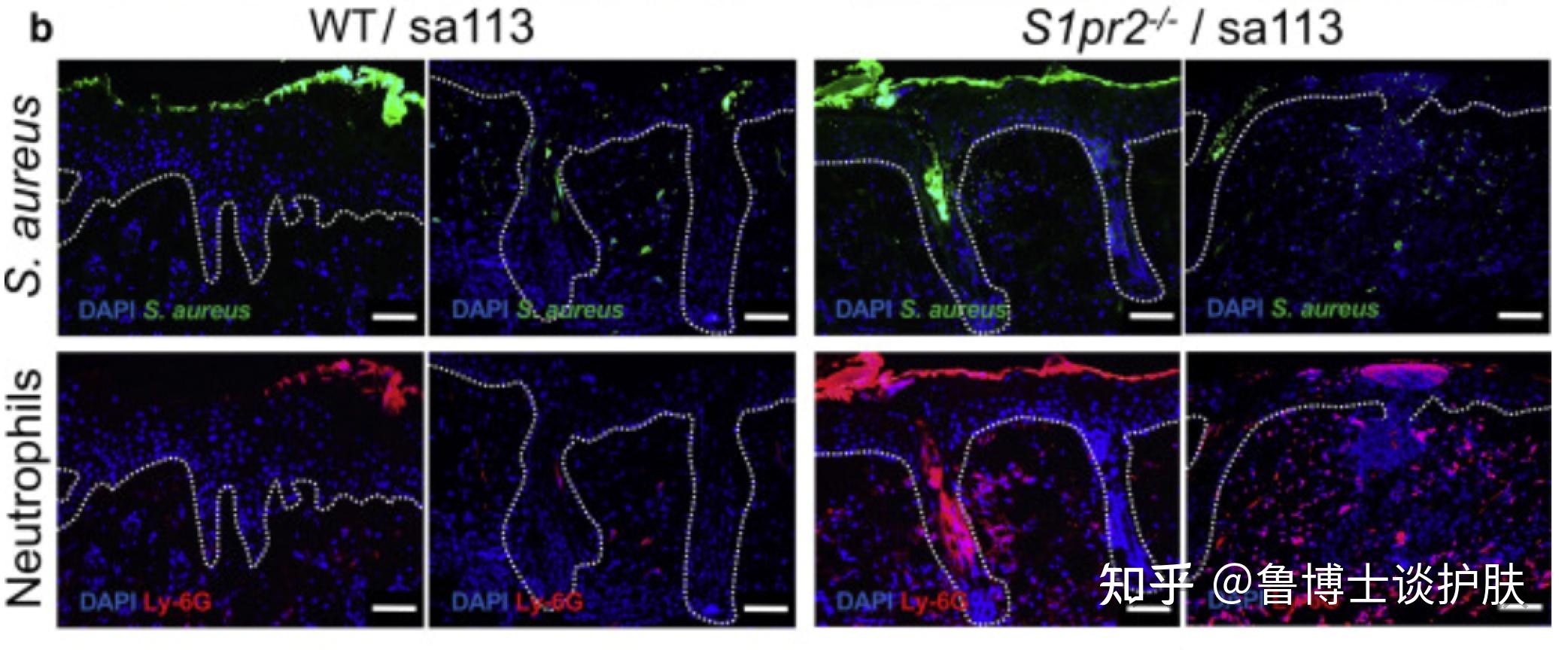 S1PR2是维持皮肤屏障稳态的关键蛋白 - 知乎