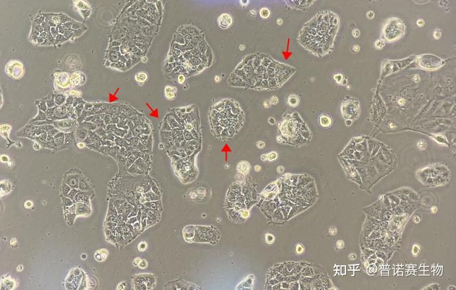 细胞学堂 | Caco-2细胞生长特性和常见问题解决策略 - 知乎