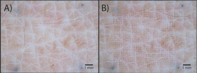 Rox Anderson：从激光医学之父到最成功的医生创业者 - 知乎