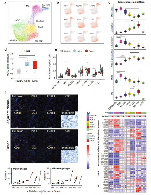 单细胞联合空间转录组剖析人类前列腺免疫抑制肿瘤微环境 - 知乎