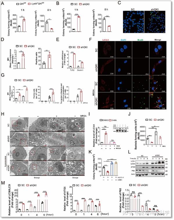 Cell Biosci︱空军军医大学汪莉/卢兹凡团队发现RNA结合蛋白QKI有望成为治疗耐甲氧西林金黄色葡萄球菌感染的新靶点 - 知乎