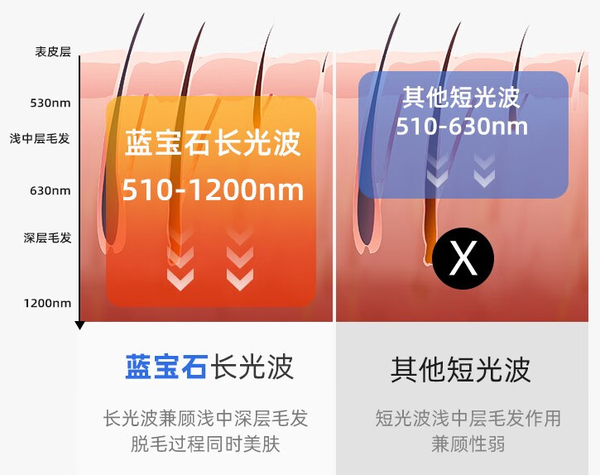 Ulike air3脱毛仪：高密度、快闪、冰感IPL脱毛仪来袭，告别传统脱毛方式剃须刀和脱毛膏，轻松脱毛拥有无毛柔滑美肌 - 知乎