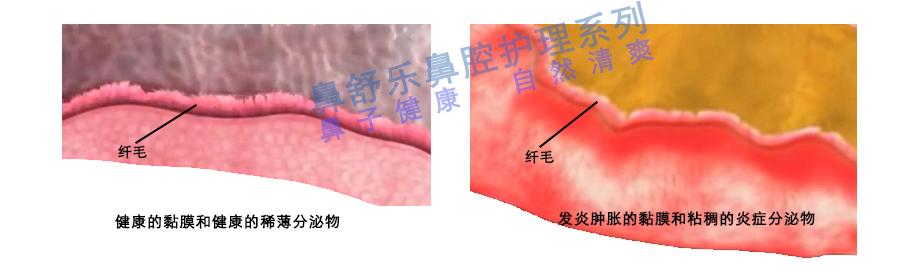你的慢性咽炎是怎么治好的? 知乎