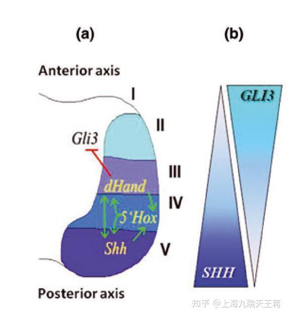 多指畸形—家长们看这一篇就够了 - 知乎