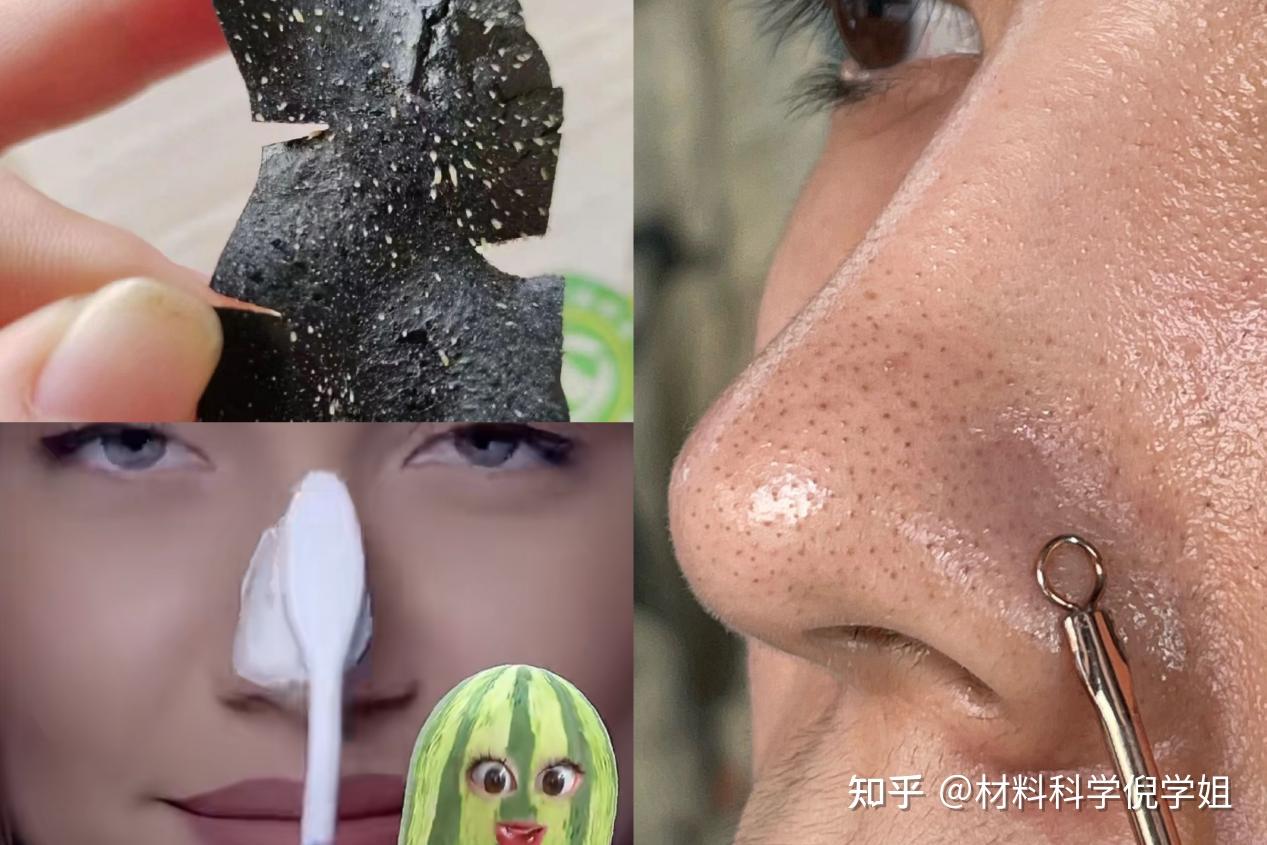 【专业配方师经验分享】激光去黑头是我做过最后悔的事了！去黑头做对这4步，7天让黑头连根拔起，草莓鼻、粗毛孔统统拿捏！ 知乎