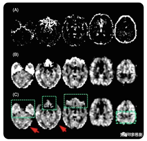 ASL 的最新技术发展：对最新技术的回顾 - 知乎
