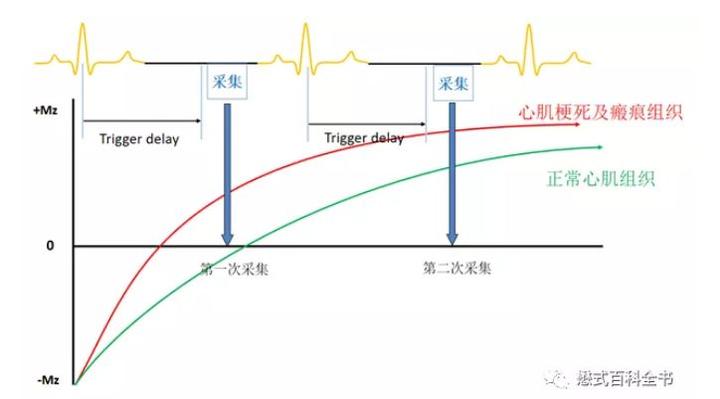 PSIR序列原理及临床应用 - 知乎