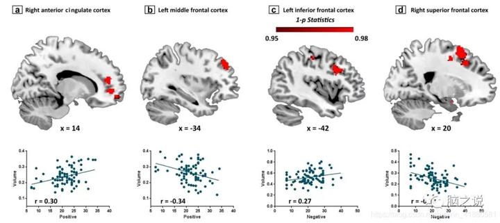 不同的工具包对Voxel-based morphometry (VBM)计算结果的影响 - 知乎