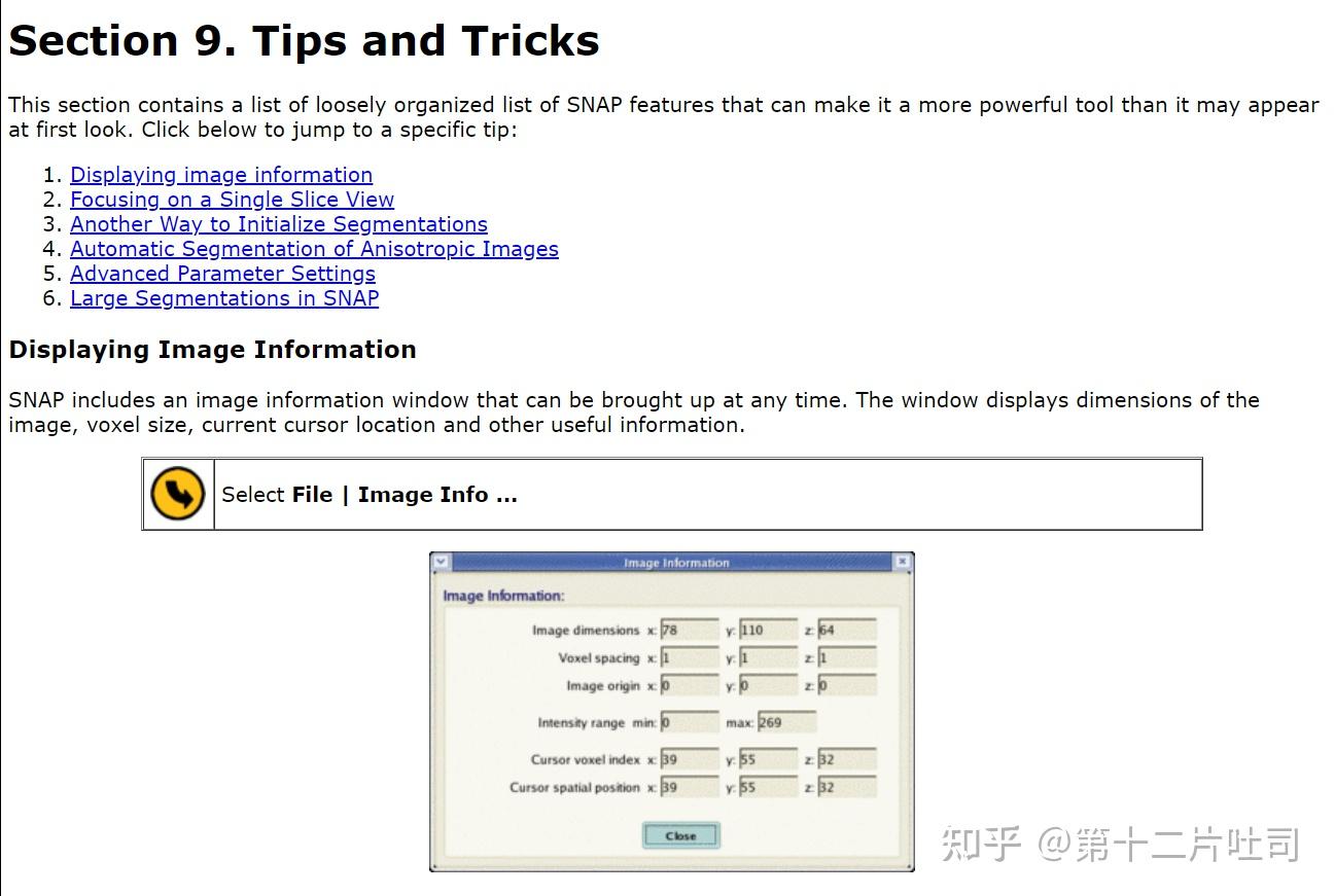 医学影像：ITK-SNAP如何查看“四维”nii文件 - 知乎
