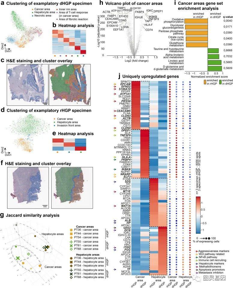 Mol Cancer | 单细胞分辨率下肿瘤不同组织学生长模式(HGP)的分子差异 - 知乎