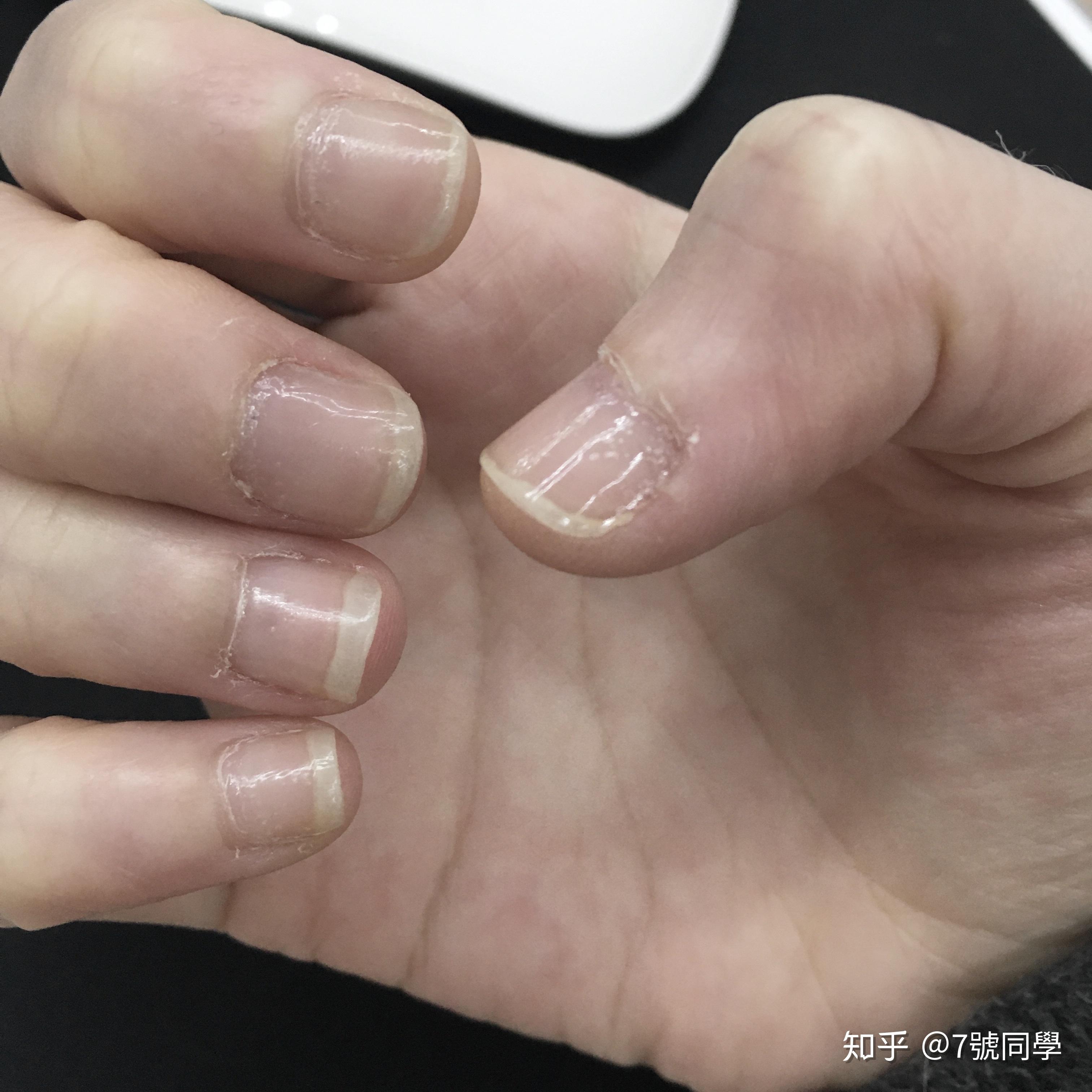 留长指甲会使甲床变长吗? 知乎