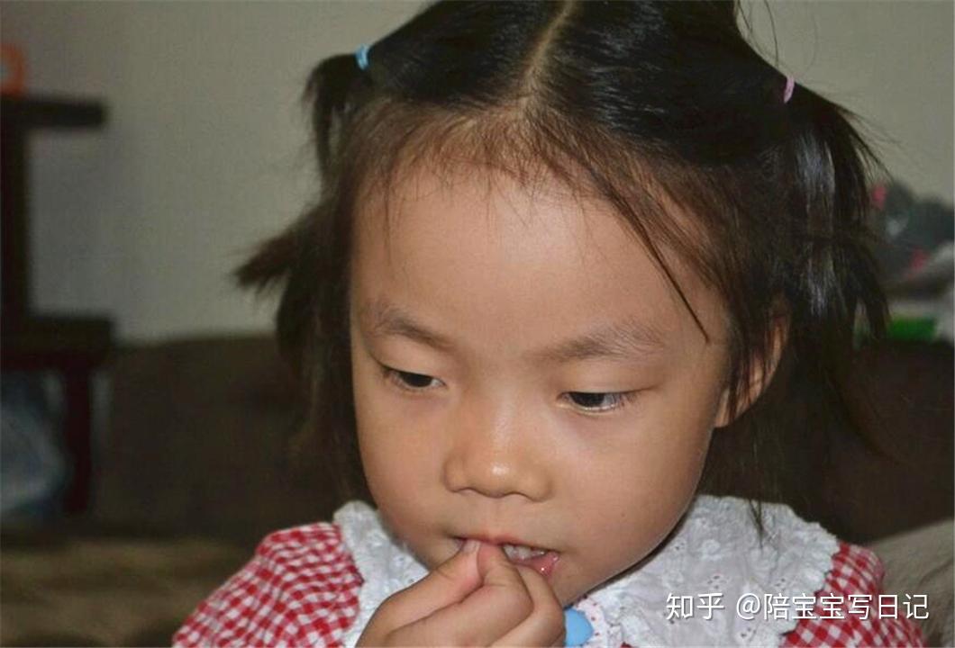 王一博被拍到啃手指甲长大后仍啃指甲的孩子,大多有两个原因 知乎