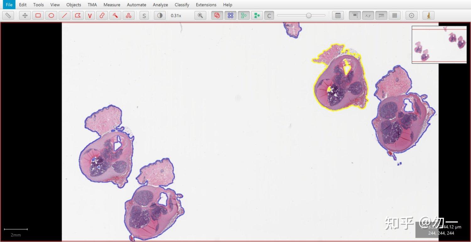[数字病理]使用QuPath检测组织（机翻版） - 知乎