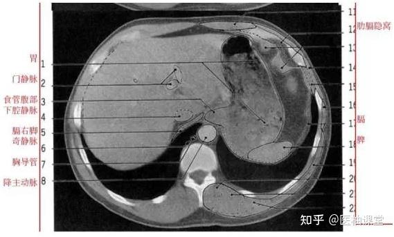 教你读懂胸部CT - 知乎
