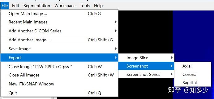 ITK-snap单层影像导出操作方法 - 知乎