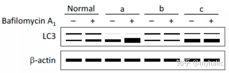 盘下这 7 点，自噬研究中检测 LC3 岂会那么难？！ - 知乎