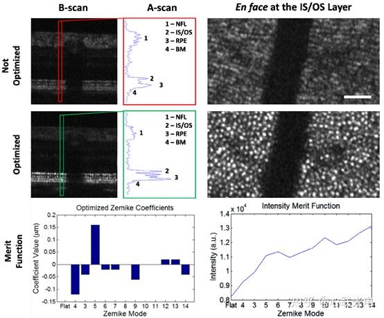 Biomed Opt Express：无波前传感器自适应光学相干断层成像（WSAO-OCT）在人视锥细胞镶嵌体活体成像中的应用 - 知乎