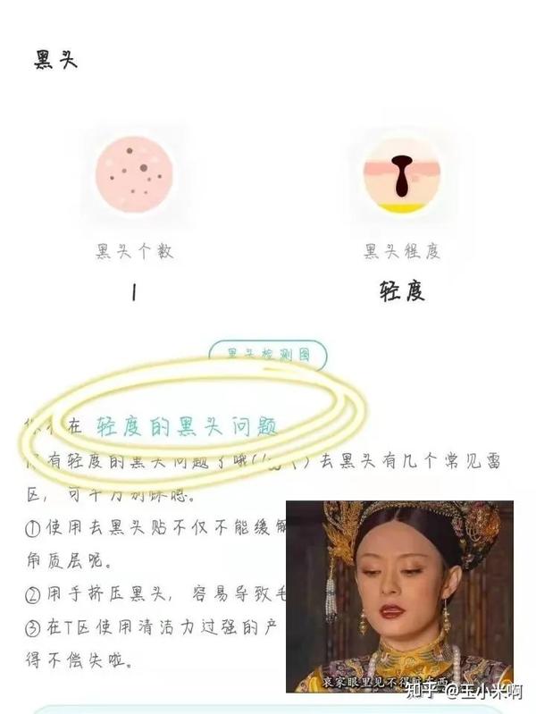 为什么各种方法都试过了,黑头还是反反复复,有什么克黑头反复、毛孔大,真有用的那种!!! 知乎