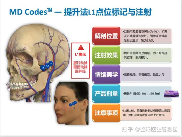 MD Codes 注射法，我为什么不教！ - 知乎