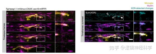 解析Nat Neurosci︱前沿! 小胶质细胞吞噬髓鞘并修饰髓鞘发育 - 知乎