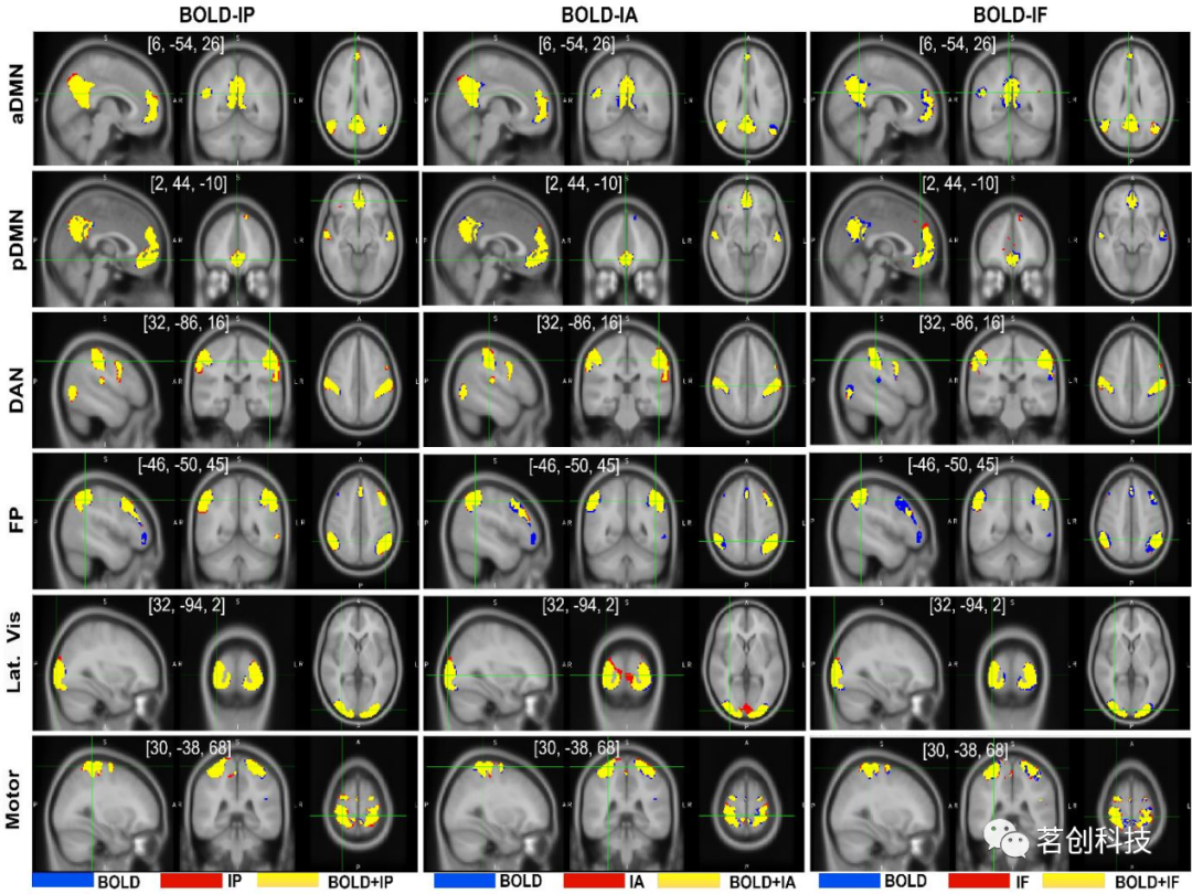 fMRI时间序列振幅和相位对功能连接分析的影响 - 知乎