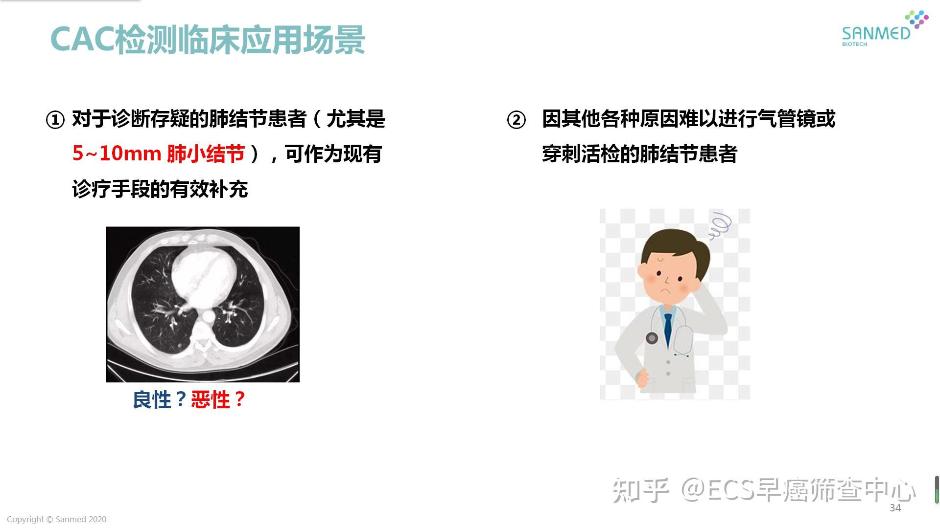 肺结节最早的良恶性确诊检查是什么——cac检测 知乎