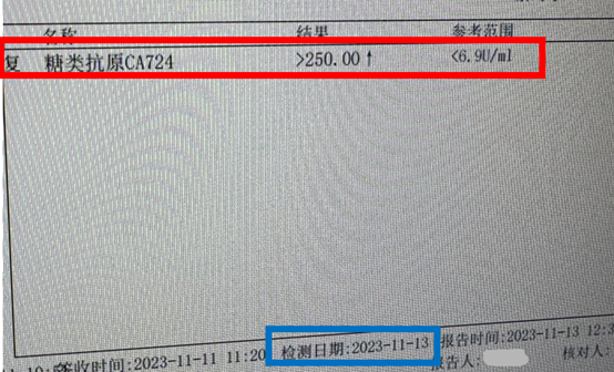 恰当看待血清CA724升高 - 知乎