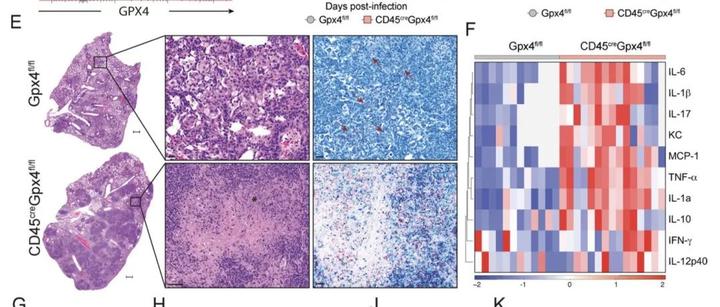 免疫学顶刊JEM丨GPX4-结核病-细胞死亡丨从临床到基础 - 知乎