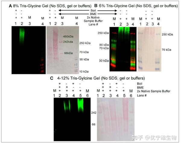 【小优细节君】胶原蛋白为何难检测？WB没有条带、分子量也不对…… - 知乎