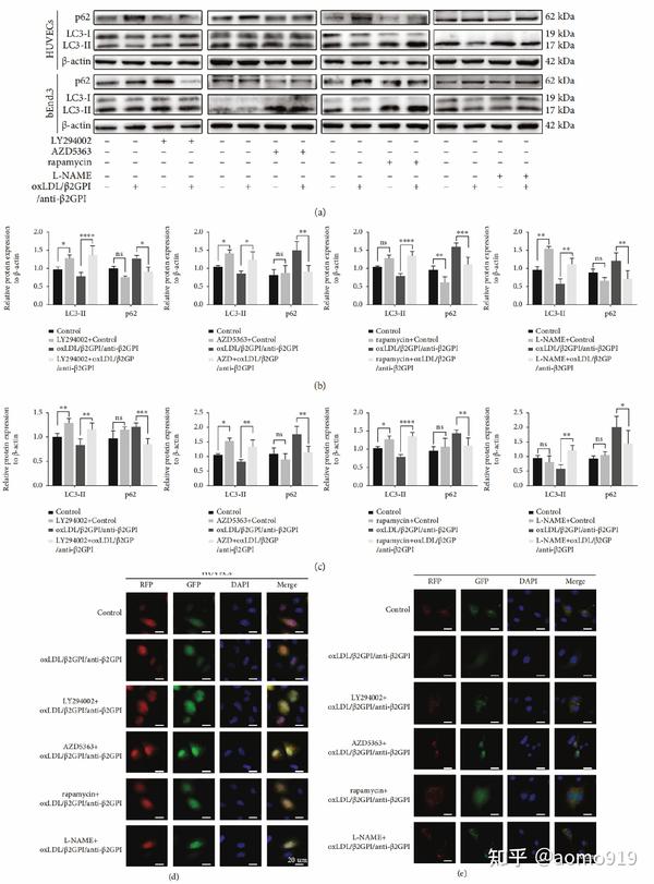 AbMole科研-oxLDL/β2GPI/抗-β2GPI复合物通过PI3K/AKT/mTOR和eNOS信号通路诱导的自噬受损有助于内皮细胞功能 ...