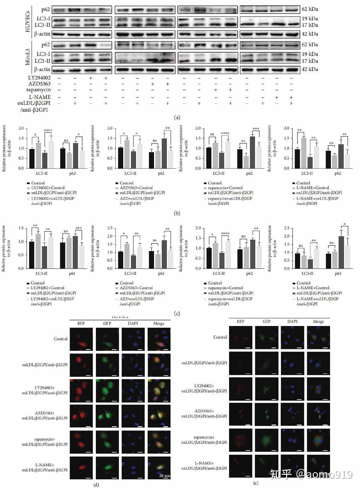 AbMole科研-oxLDL/β2GPI/抗-β2GPI复合物通过PI3K/AKT/mTOR和eNOS信号通路诱导的自噬受损有助于内皮细胞功能 ...