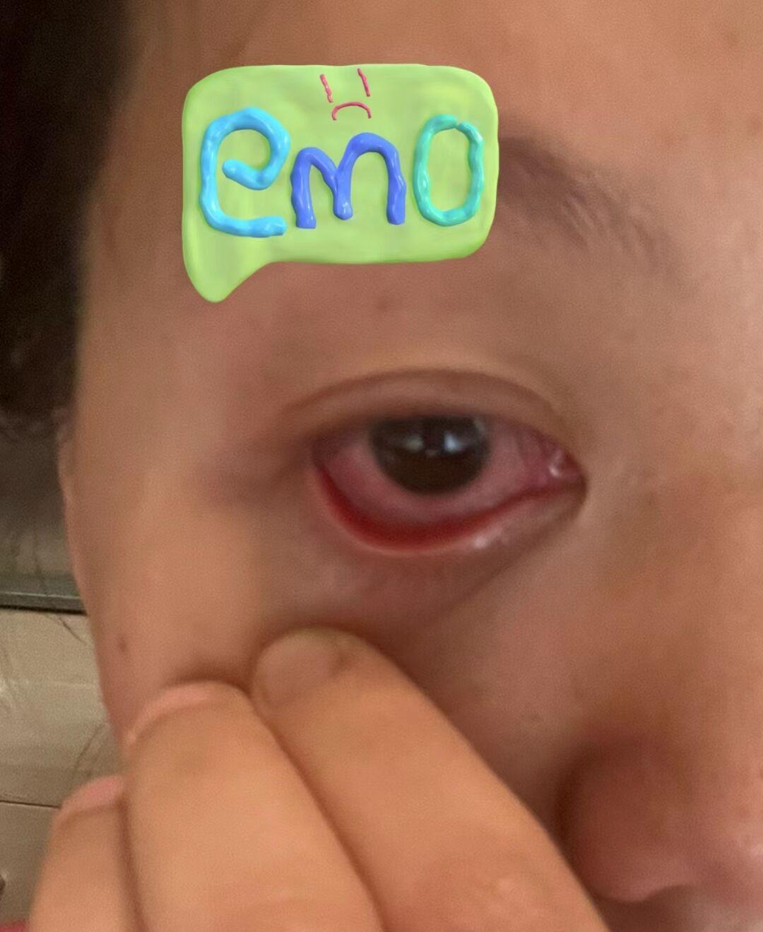 SOSK倍清亮护眼贴真的像大家说的那么好用么？真实测评反馈一下 - 知乎