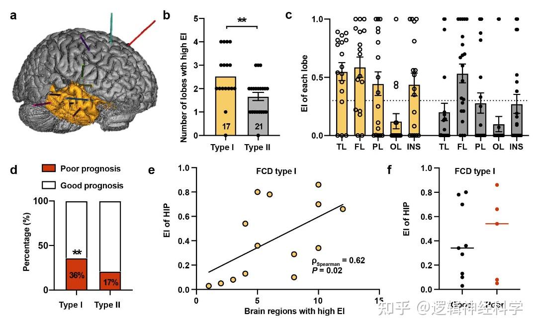 STTT︱浙江中医药大学陈忠/丁美萍/徐层林团队揭示海马中间神经元兴奋性转化是皮质发育不良相关癫痫的关键 - 知乎
