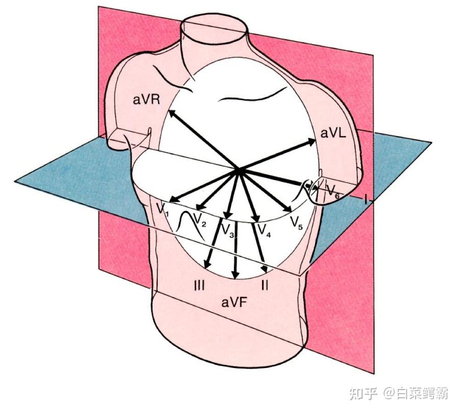心血管系统｜心电图基础 ECG / Electrocardiography - 知乎