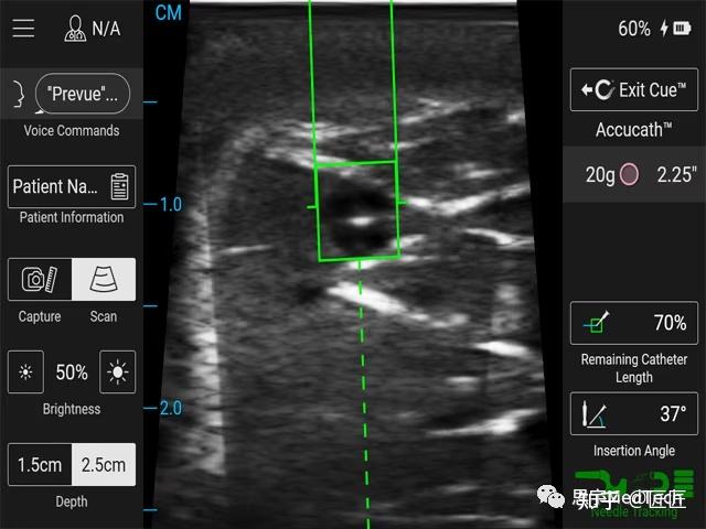 关注！医疗巨头推出超声新品 - 知乎
